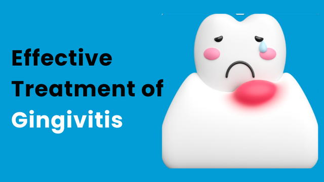 Beat Gingivitis: Ultimate Treatment Guide – Stim Brushes